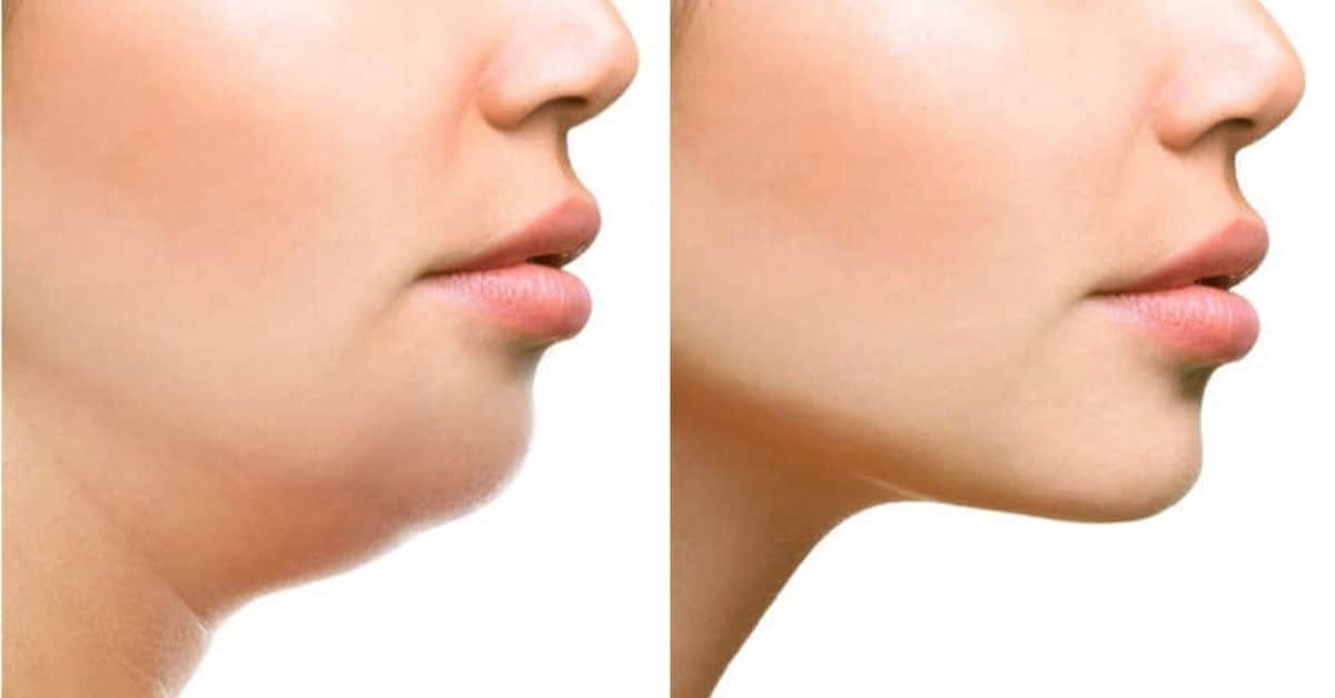 How To Get Rid of a Double Chin | Good Fun Health